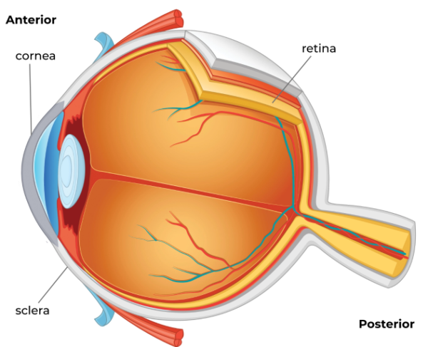 Nephropathic & Ocular Cystinosis Causes, Symptoms & Treatment